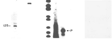 S1 Nuclease And Primer Extension Mapping Of ß Tubulin Mrna Panel A