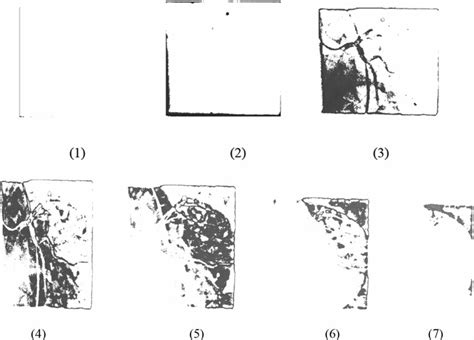 classified segment using expectancy maximization based segmentation