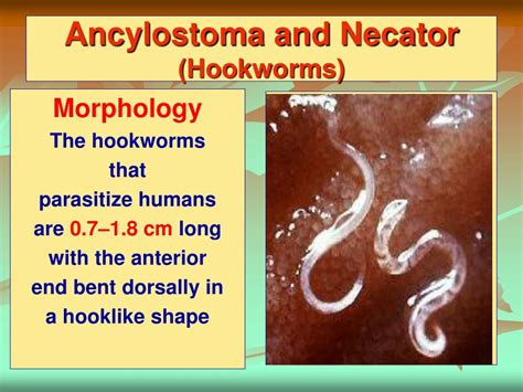 Ppt Nematodes 2 Powerpoint Presentation Free Download Id4923754
