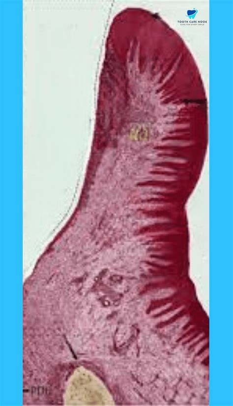 What Is Junctional Epithelium