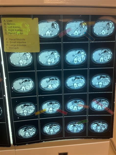 Organs Xray Diagram Quizlet