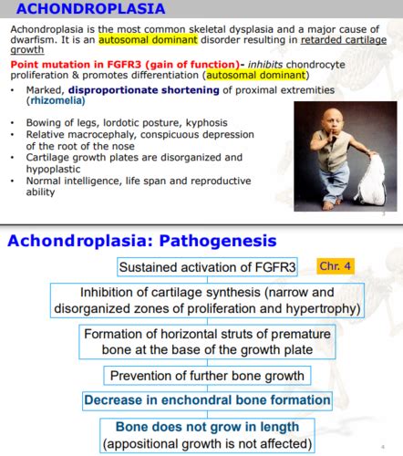 Developmental And Acquired Pathologies Of Bone Flashcards Quizlet