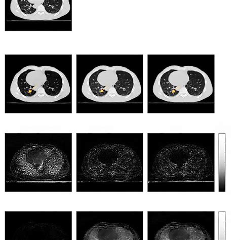 Comparison Between Sequential And Non Sequential Transfer Learning For Download Scientific