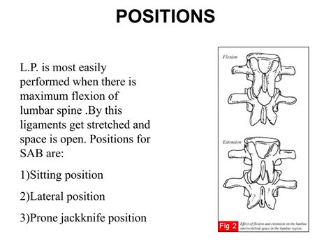Spinal And Epidural Anaesthesiapptx