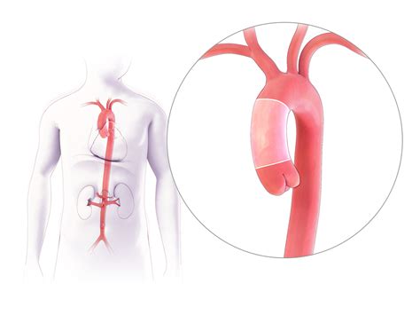 Anatomy Of Aorta