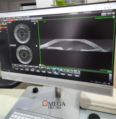 Dri Oct Triton Strumenti Oftalmici Vendita Assistenza Omega Electra