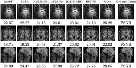 plug and play algorithms parameters tuning and interpretation