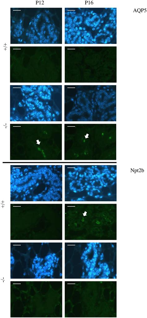 Defects Of Mammary Epithelium Development And Differentiation On Days
