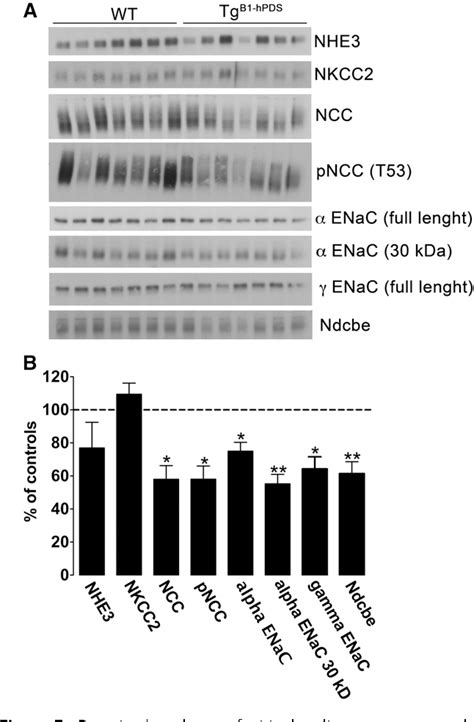 Figure 1 From Overexpression Of Pendrin In Intercalated Cells Produces