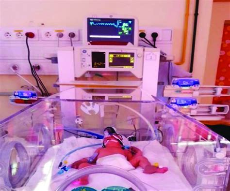 Late Preterm Newborn With O 2 Therapy Non Invasive Ventilation