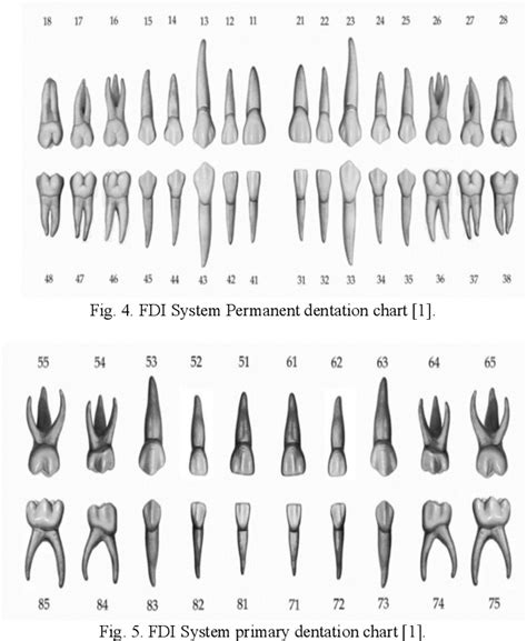 Figure 14 From Introduction Of New Tooth Notation Systems In Comparison With Currently In Use