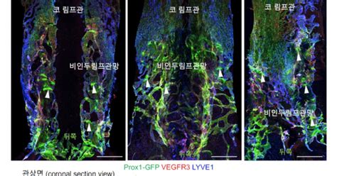 뇌 속 노폐물 청소해 치매 막는다···뇌척수액 배출 경로 찾았다