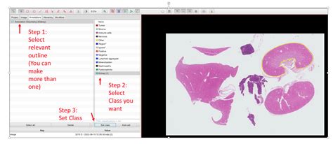 Annotate Slides In Qupath Dyi Image Analysis
