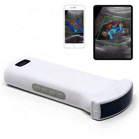 Convex Pregnancy Color Doppler Ultrasound Pocket 256 Elements