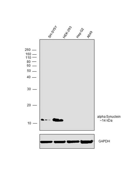 Invitrogen Alpha Synuclein Monoclonal Antibody Syn 211 100 μg Unconjugated Antibodies