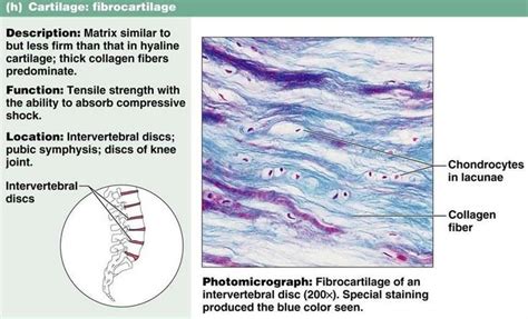 Fibrous Cartilage Labeled Hyaline Cartilage Tutorial Histology
