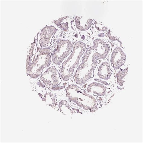 Tissue Expression Of Gdnf Staining In Testis The Human Protein Atlas