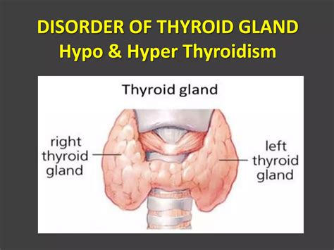 5 Thyroid Disorder Hypo And Hyper Pdf