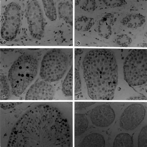 Electron Micrograph Of Early Stage Of Apoptotic Germ Cells In The