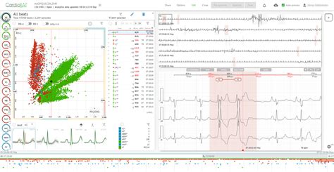ecg data analysing support center