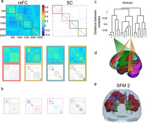 Strong Similarities Between Structural And Functional Brain Networks