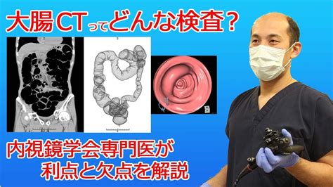 【大腸がん】受けていますか？大腸がん検診「大腸ctってどんな検査？」 Youtube