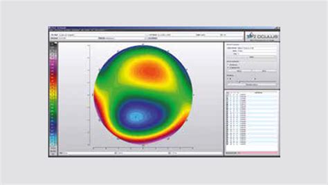 Oculus Keratograph® 5m Advanced Corneal Topographer