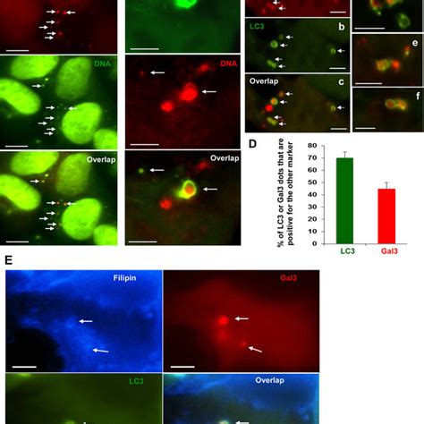 Cpp Induced Autophagy Requires Clathrin Dependent Endocytosis Hek293