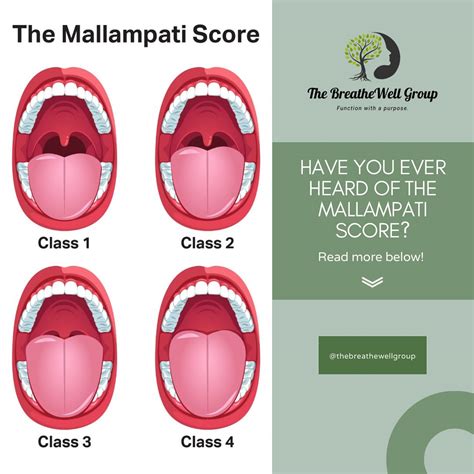 The Breathewell 🔎 What Is The Mallampati Score 🩺 The Mallampati Score Is A Simple Assessment