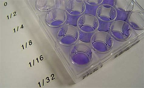 New Standard For Biocompatibility Testing 2019 01 04 Assembly