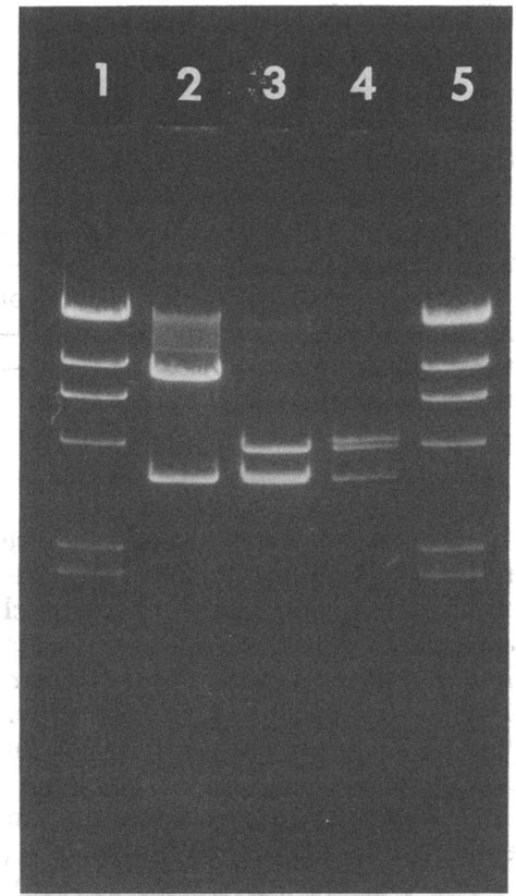 Agarose Gel Electrophoresis Of Plasmid Dnas Digested With Bamhi Dna Download Scientific