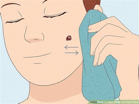 7 Ways To Heal Scabs On Your Face Wikihow