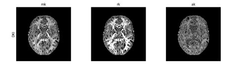 Reconstruction Of The Diffusion Signal With The Kurtosis Tensor Model