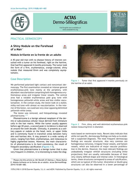 Pdf A Shiny Nodule On The Forehead Of A Man