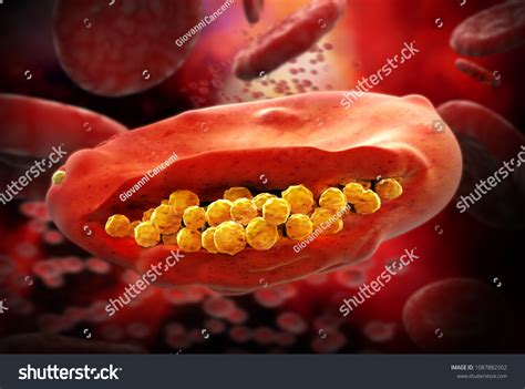 2 825 Malaria Bacteria Bilder Stockfotos Und Vektorgrafiken Shutterstock