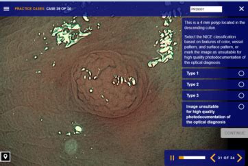 Narrow Band Imaging Nbi Olympus Professional Education On Demand