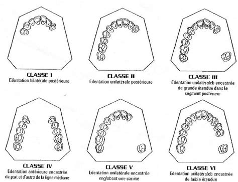 La Classe De Kennedy Encyclodontiefr