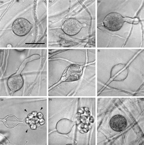 Sporangia And Hyphal Swellings Of Pythium Litorale A C Sporangia Download Scientific Diagram