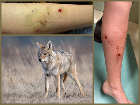 Coyote Attacks Young Girl At A Highway Rest Stop