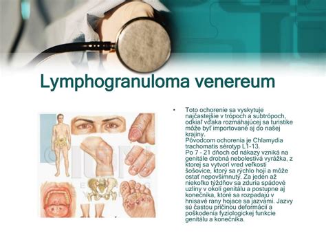 Ppt Pohlavné Choroby Powerpoint Presentation Free Download Id 5556936