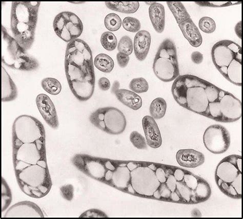 Transmission Electron Microscopy Tem Image Of Rhodococcus Opacus