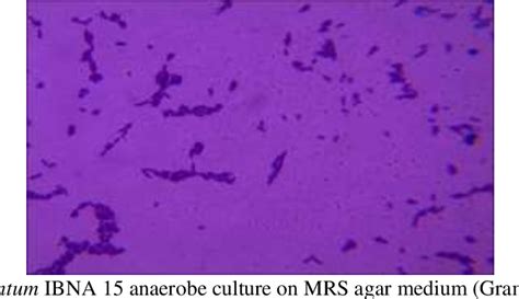 Figure 1 From Lactobacillus Spp And Enterococcus Faecium Strains Isolation Identification