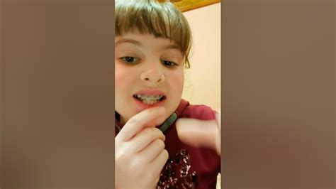 Greenscreen Braces Funny Fun Trend Youtube