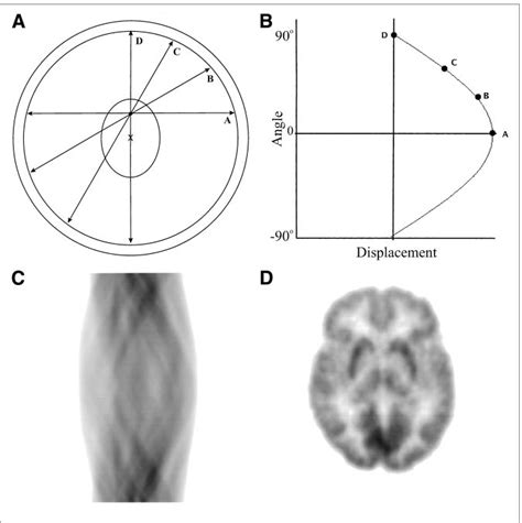 Sinogram Formation Coincidence Events In Pet Scanner Are Categorized