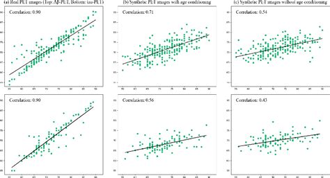Figure 5 From A Prior Information Guided Residual Diffusion Model For