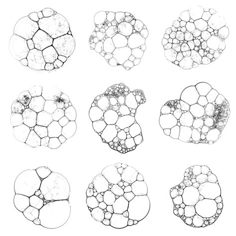 Atherom Bilder Kostenloser Download Auf Freepik