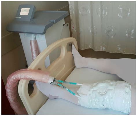 Evaluation Of The Clinical Efficacy Of Using Thermal Camera For