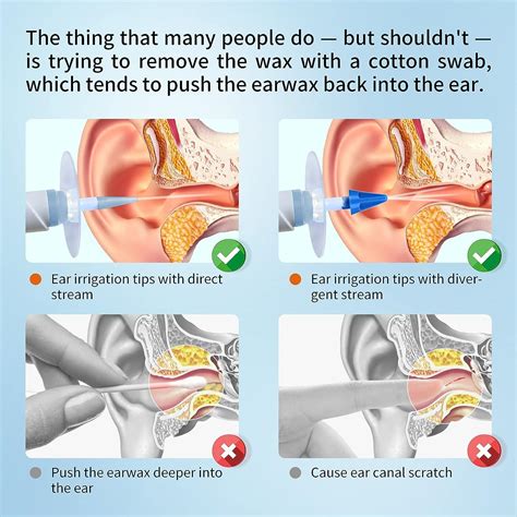 Ear Wax Removal Kit Safe And Effective Ear Cleaning With Earigator 4