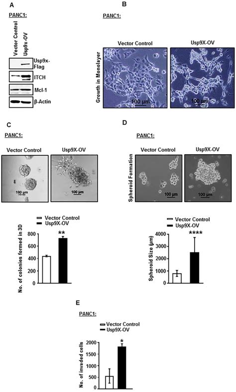 Usp9x Promotes Survival In Human Pancreatic Cancer And Its Inhibition Suppresses Pancreatic