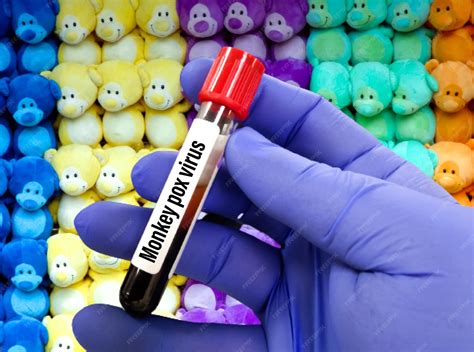 Premium Photo Blood Sample For Monkeypox Virus Test At Medical